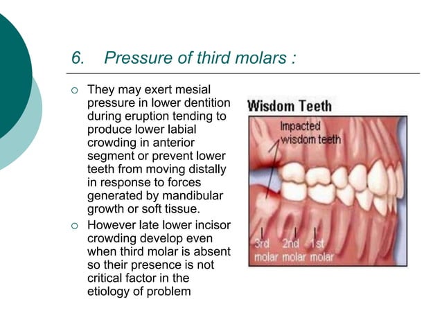 Late mandibular incisor crowding | PPT | Dental Health | Diseases and ...