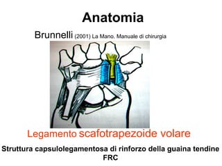 La tenodesi del FRC con resezione distale di scafoide per l’artrosi STT ...