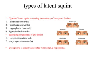 LATENT SQUINT.pptx (LATENT SQUINT,SQUINT) | PPTX