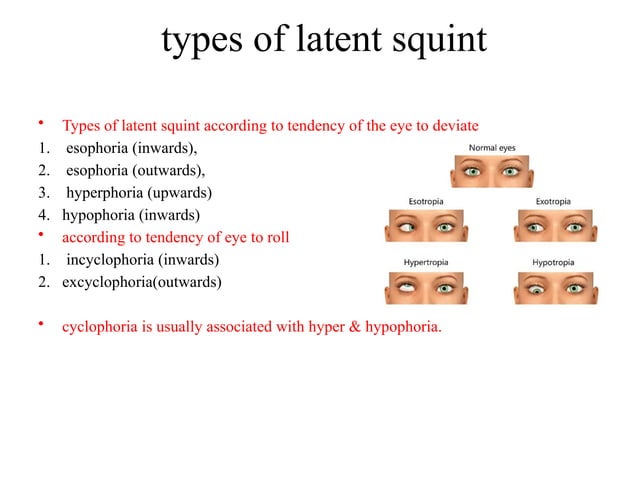 LATENT SQUINT.pptx (LATENT SQUINT,SQUINT) | PPTX | Eye and Vision ...
