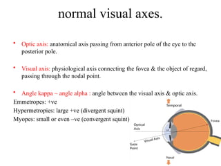 LATENT SQUINT.pptx (LATENT SQUINT,SQUINT) | PPTX