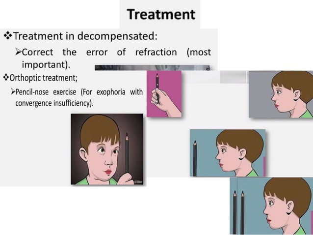 Latent and concomitant strabismus | PPT