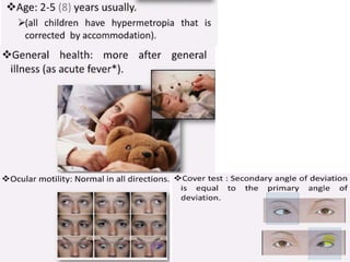 Latent and concomitant strabismus | PPT