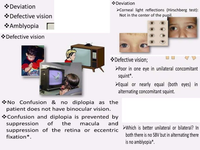 Latent and concomitant strabismus | PPT