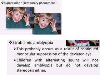 Latent and concomitant strabismus | PPT