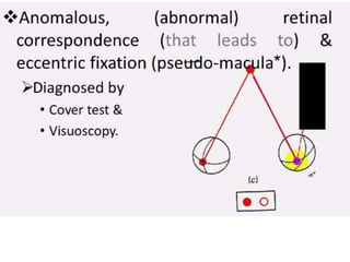 Latent and concomitant strabismus | PPT