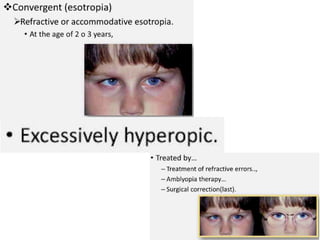 Latent and concomitant strabismus | PPT