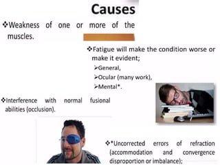 Latent and concomitant strabismus | PPT