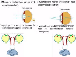 Latent and concomitant strabismus | PPT