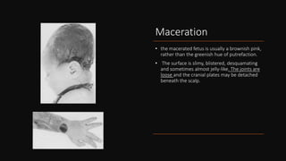 Late post mortem changes | PPTX