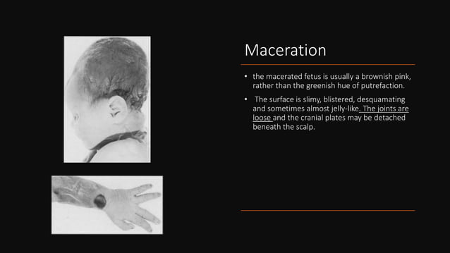 Late post mortem changes | PPTX