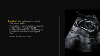 Late post mortem changes | PPTX