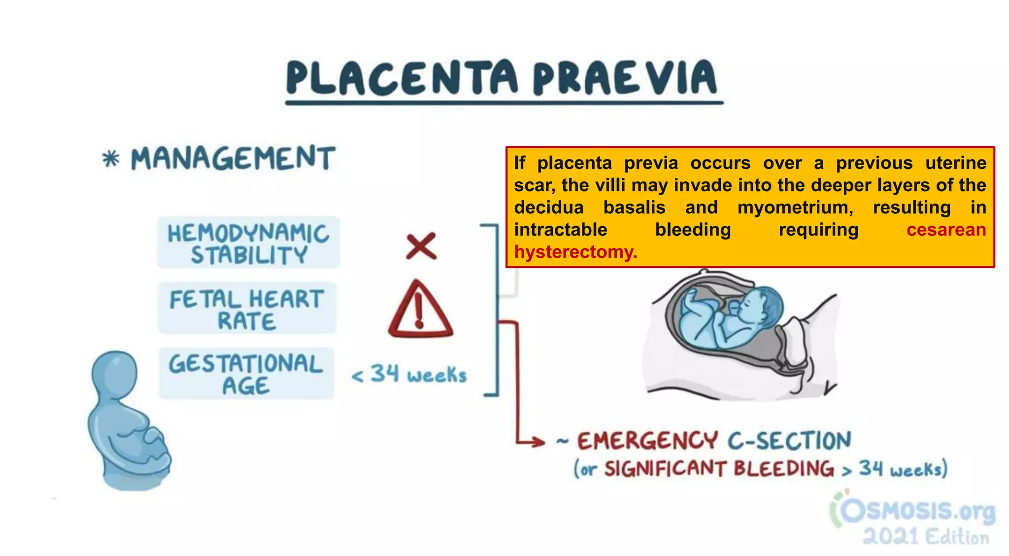 Late pregnancy bleeding Ver2 | PPT