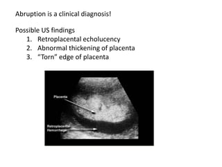 Late Pregnancy Bleeding.pptx