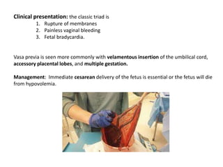 Late Pregnancy Bleeding.pptx