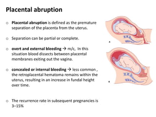 Late Pregnancy Bleeding.pptx