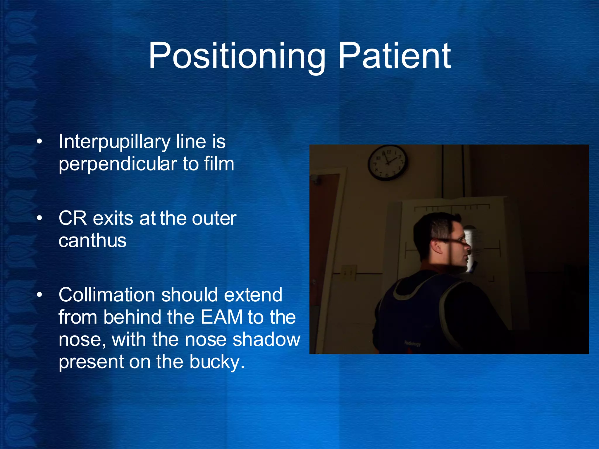 Lateral Sinus | PPT