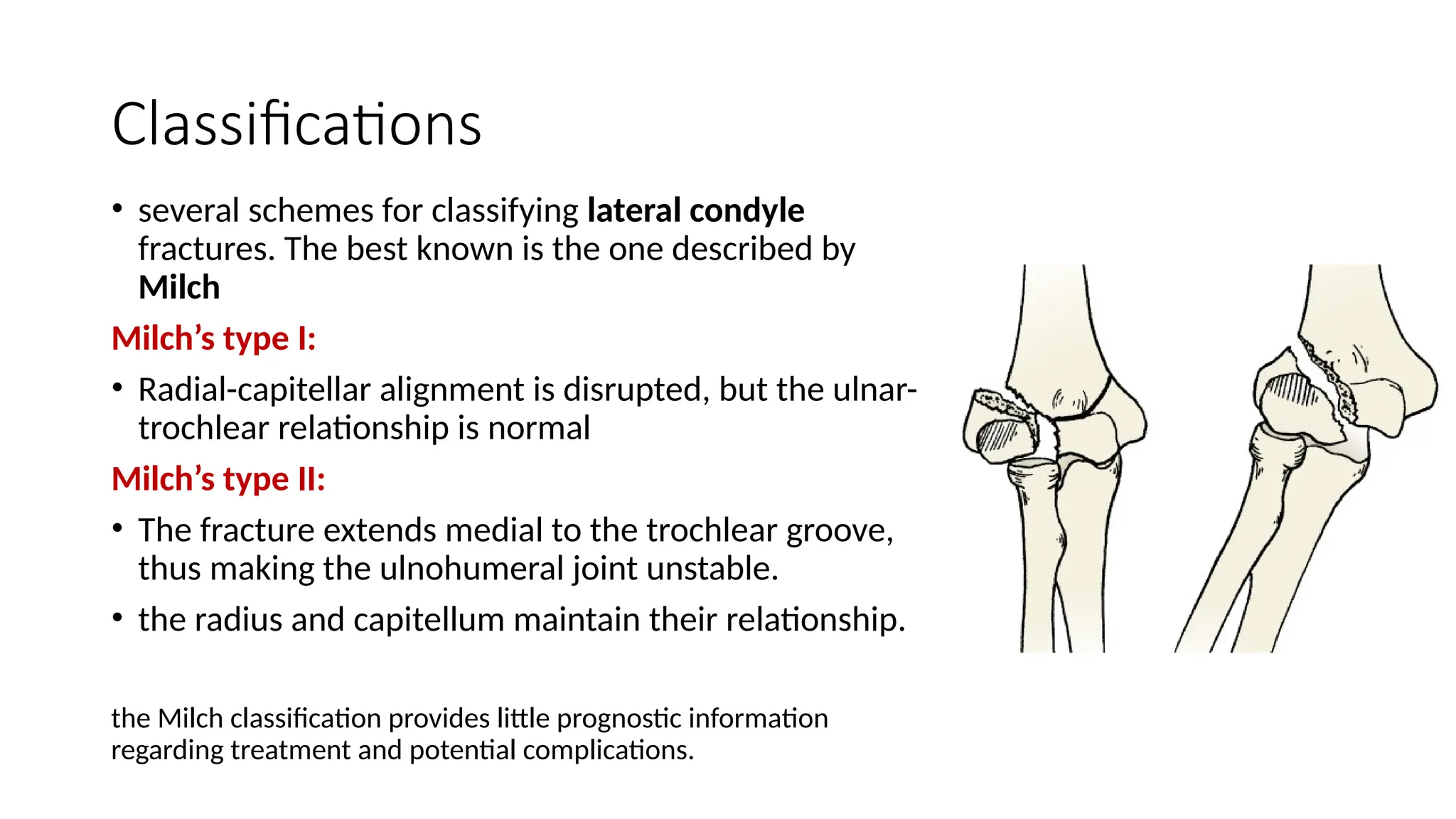 Lateral and Medial Humeral Condyle Fractures.pptx