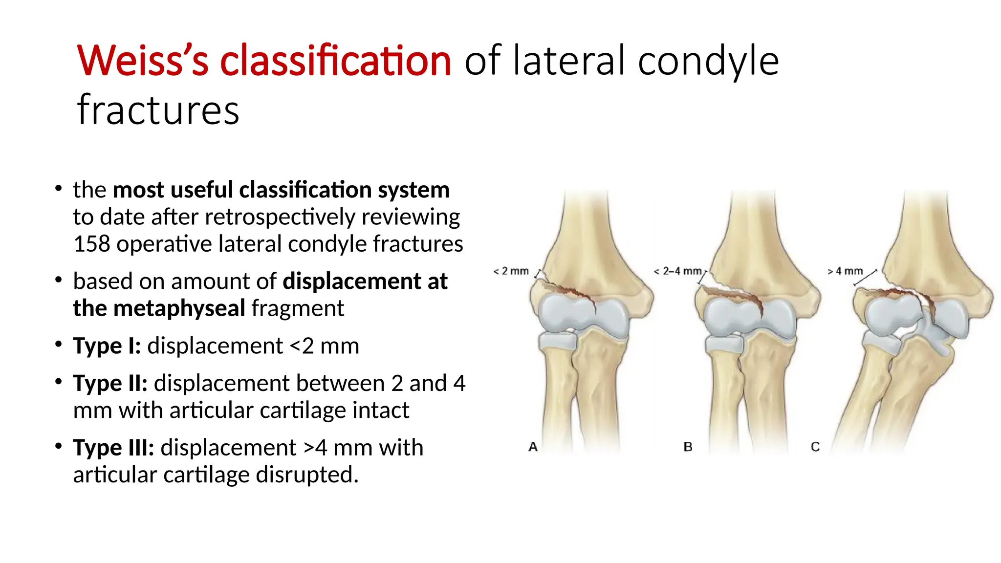 Lateral and Medial Humeral Condyle Fractures.pptx | Death, Injury, or ...