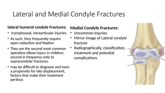 Lateral and Medial Humeral Condyle Fractures.pptx | Death, Injury, or ...