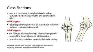 Lateral and Medial Humeral Condyle Fractures.pptx