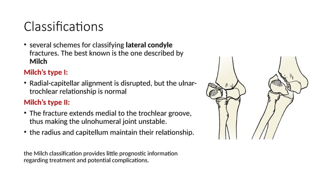 Lateral and Medial Humeral Condyle Fractures.pptx | Death, Injury, or ...