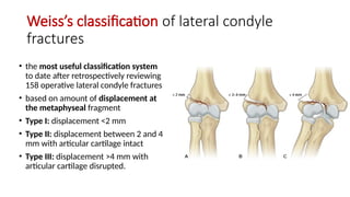 Lateral and Medial Humeral Condyle Fractures.pptx
