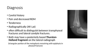 Lateral and Medial Humeral Condyle Fractures.pptx