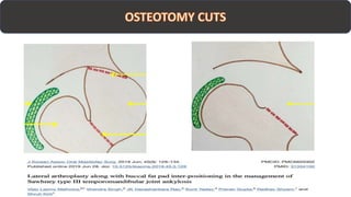 LATERAL ARTHROPLASTY PAPER.pptx