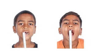 LATERAL ARTHROPLASTY PAPER.pptx