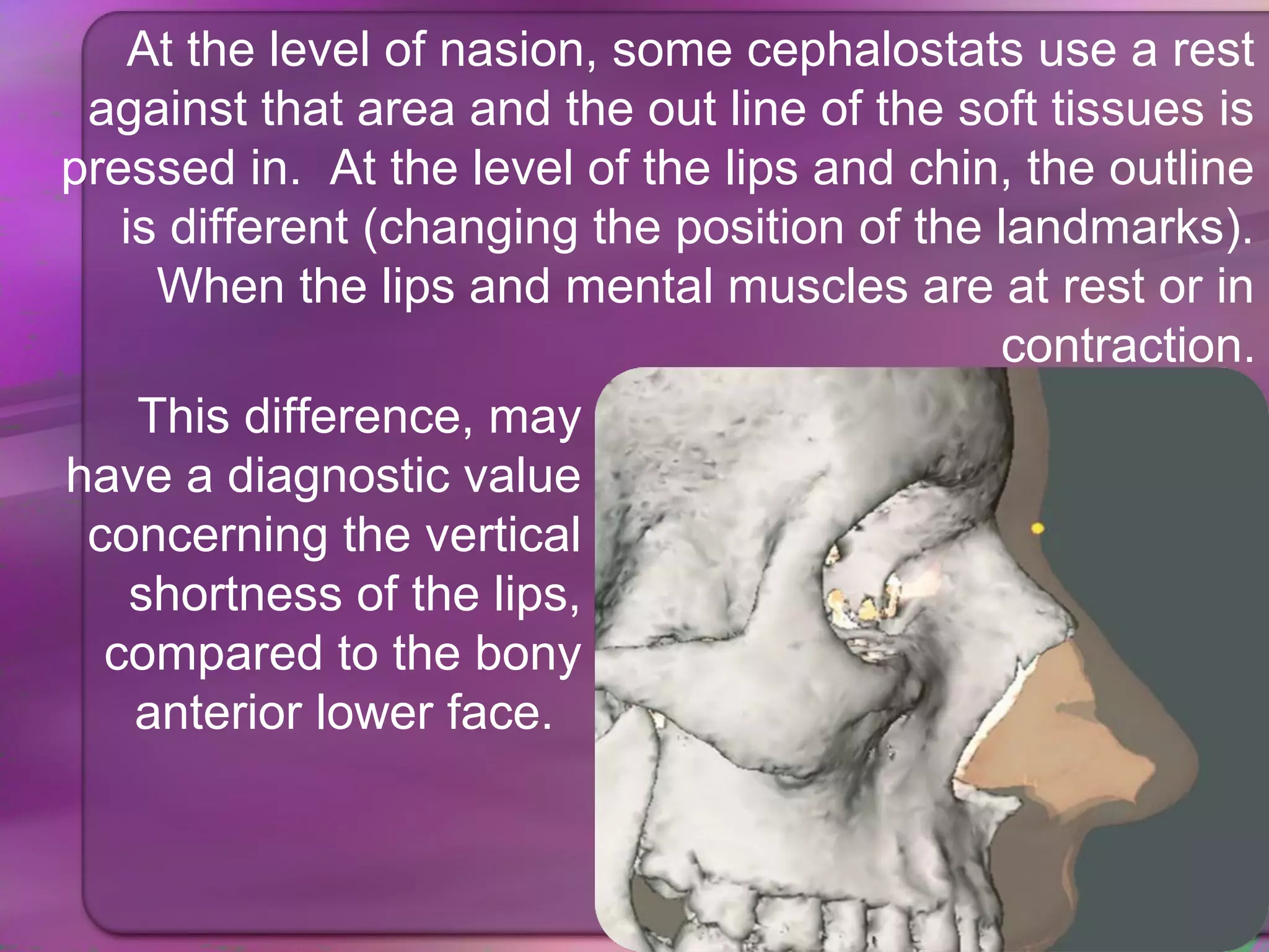 lateral cephalometric analysis in orthodontic | PPT