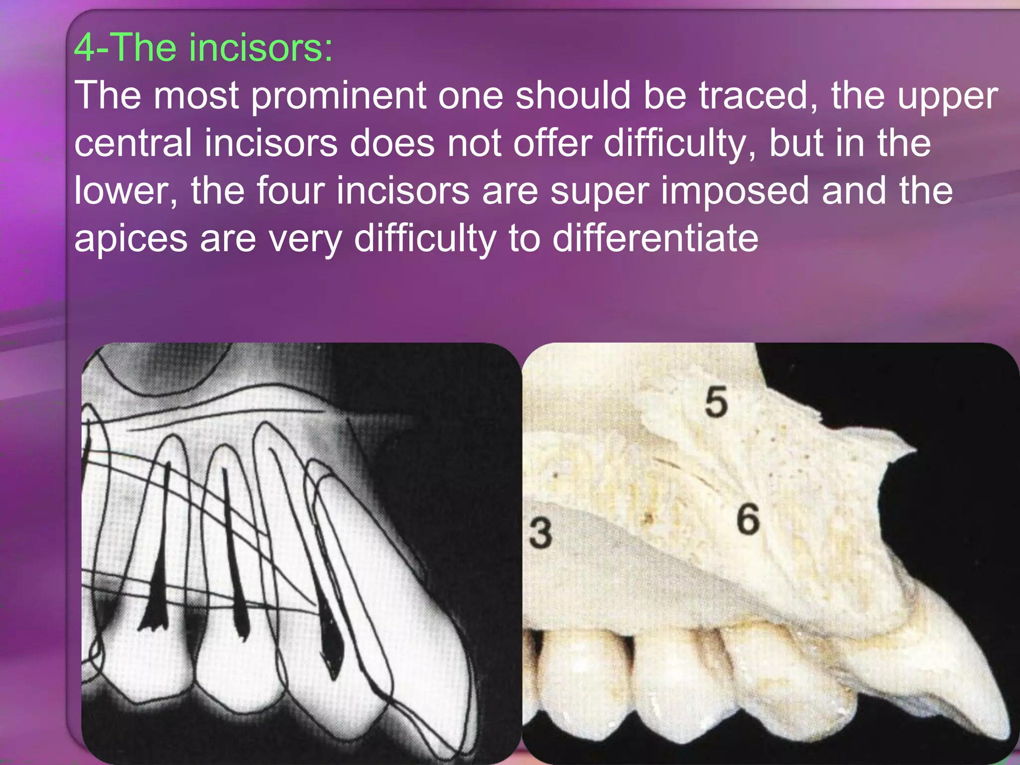 lateral cephalometric analysis in orthodontic | PPT