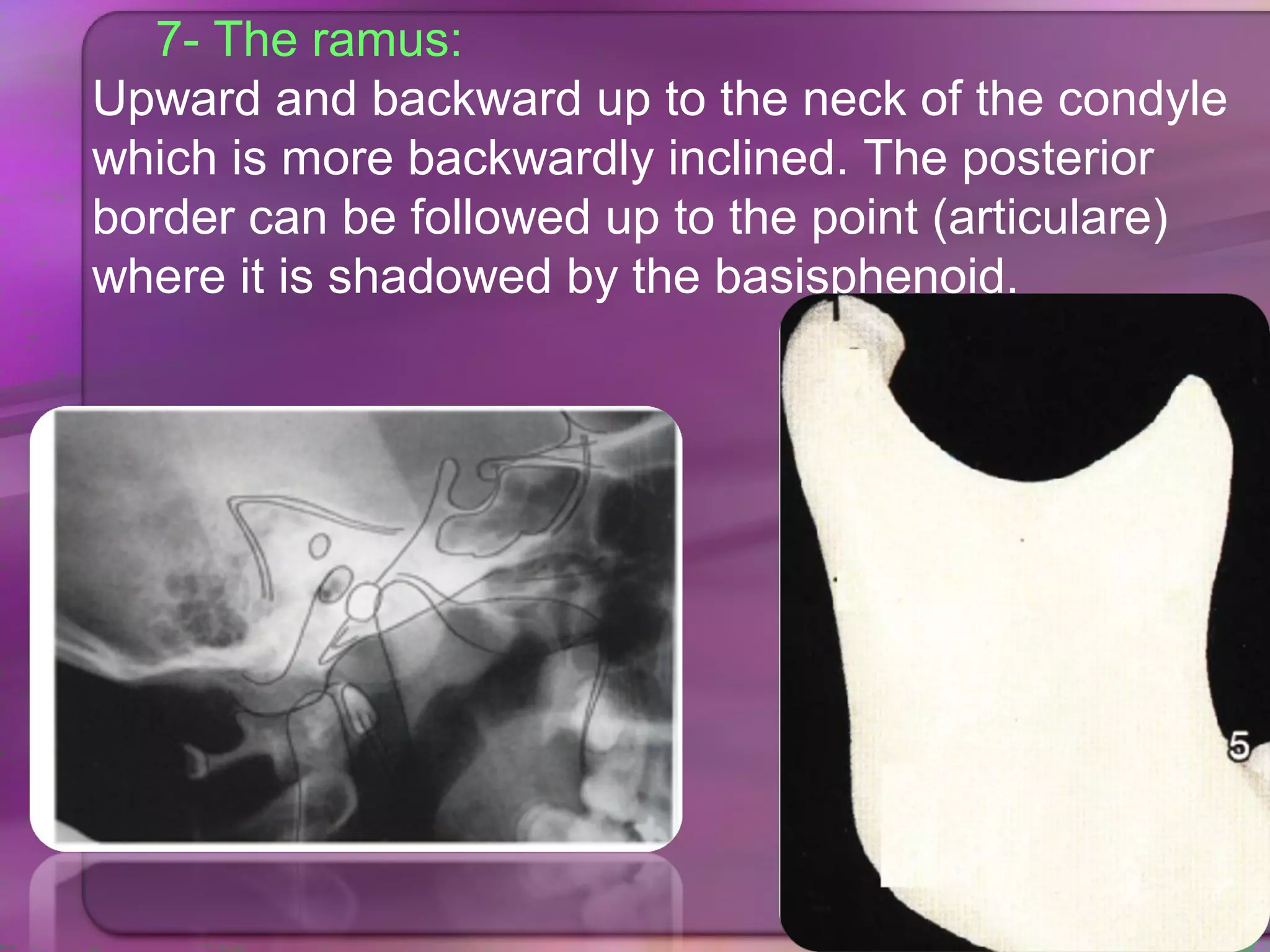 lateral cephalometric analysis in orthodontic | PPT