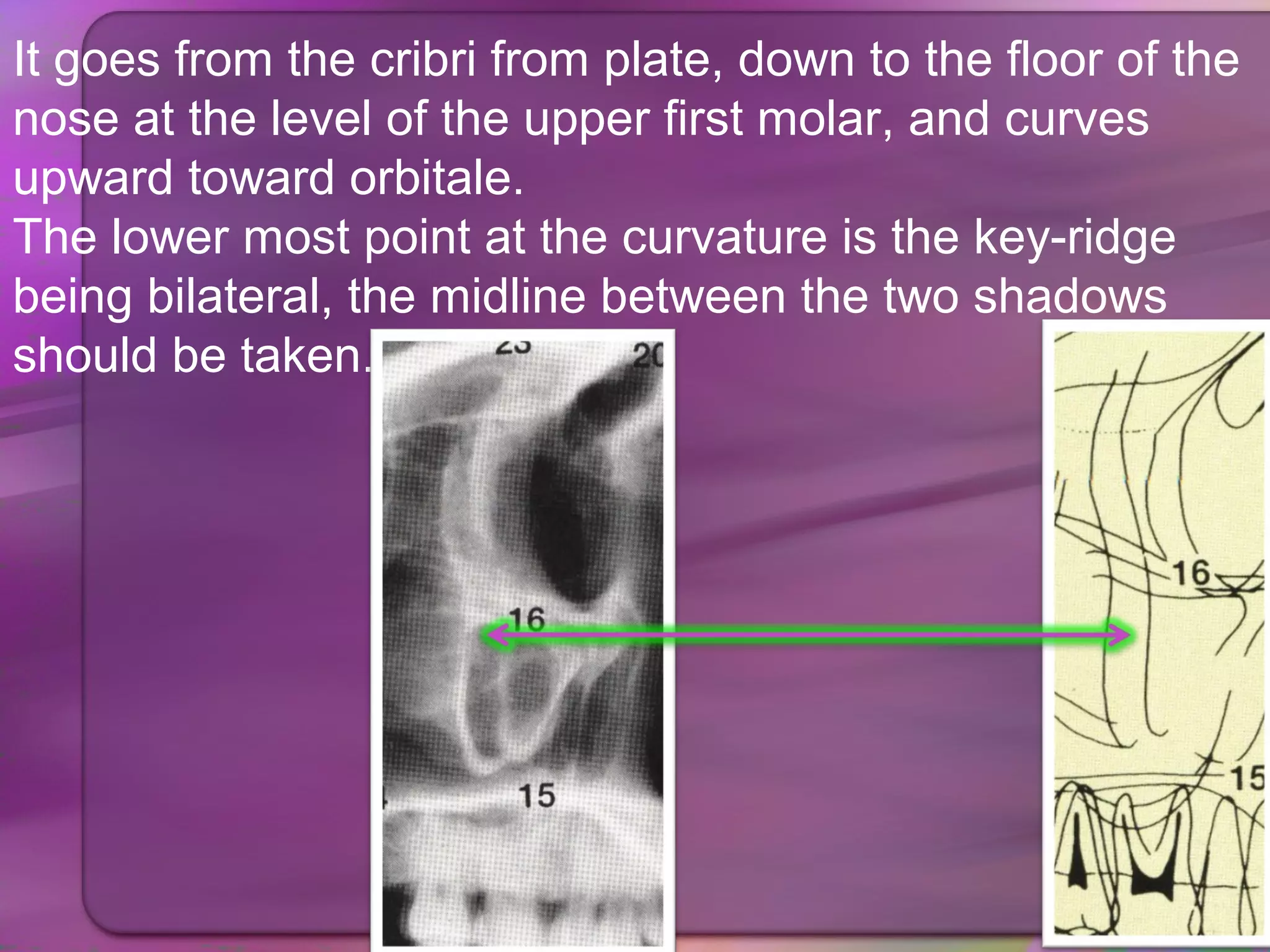 lateral cephalometric analysis in orthodontic | PPT