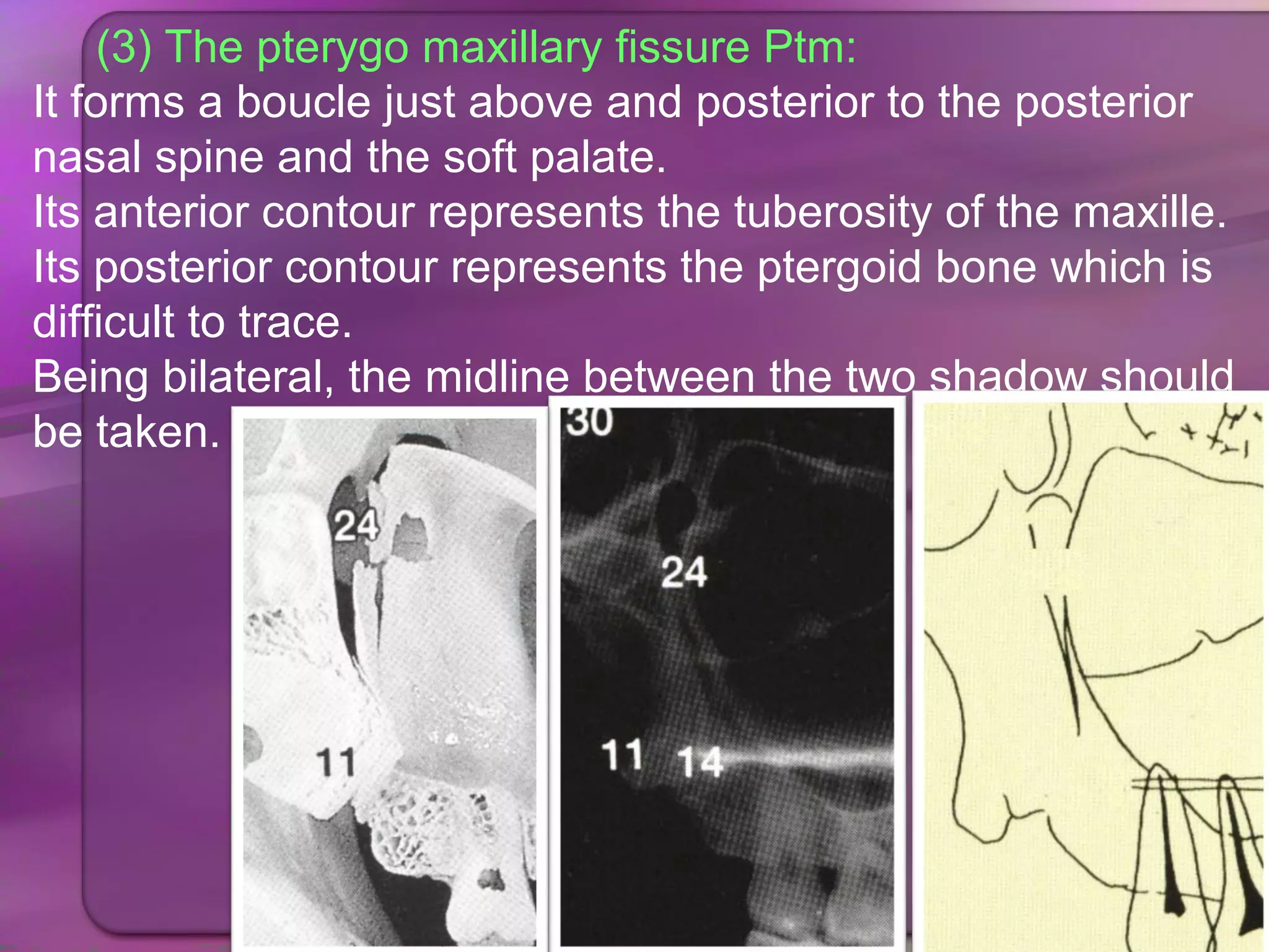 lateral cephalometric analysis in orthodontic | PPT