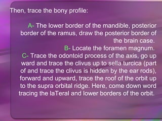 lateral cephalometric analysis in orthodontic | PPT