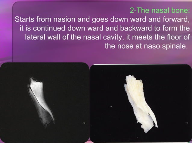 lateral cephalometric analysis in orthodontic | PPT