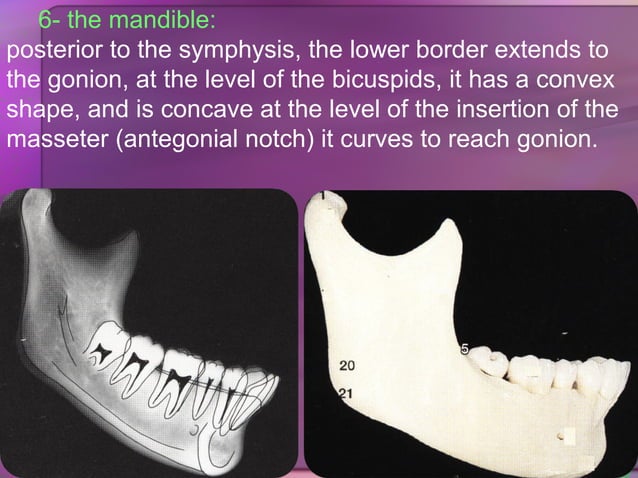 lateral cephalometric analysis in orthodontic | PPT