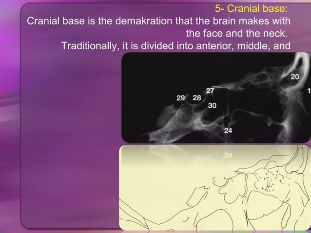 lateral cephalometric analysis in orthodontic | PPT
