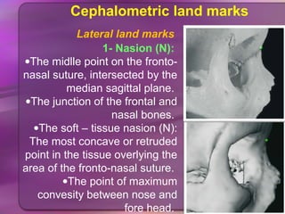 lateral cephalometric analysis in orthodontic | PPT