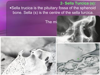 Lesser Wing Of Sphenoid Ceph