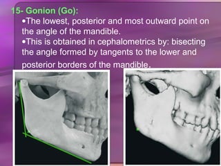 lateral cephalometric analysis in orthodontic | PPT