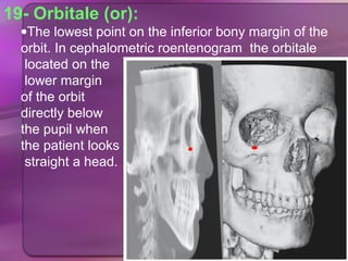 lateral cephalometric analysis in orthodontic | PPT