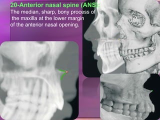lateral cephalometric analysis in orthodontic | PPT