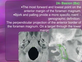 lateral cephalometric analysis in orthodontic | PPT
