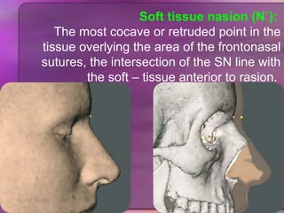 lateral cephalometric analysis in orthodontic | PPT