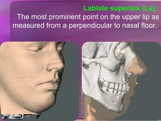 lateral cephalometric analysis in orthodontic | PPT