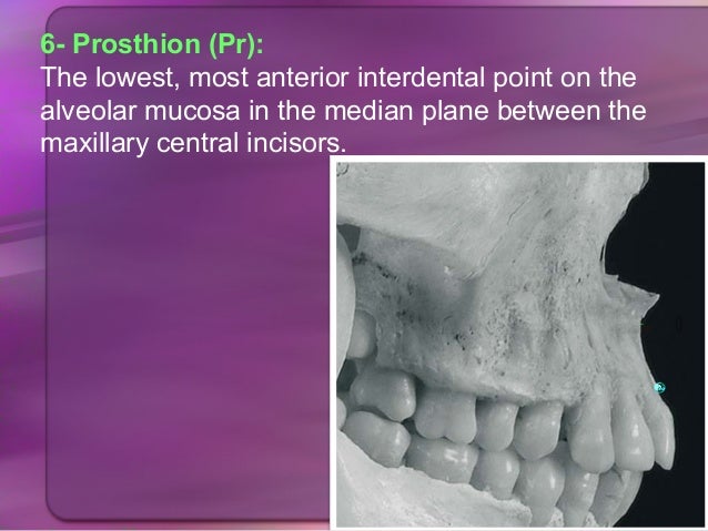 lateral cephalometric analysis in orthodontic
