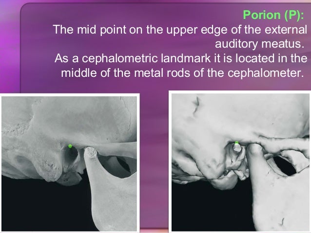 lateral cephalometric analysis in orthodontic
