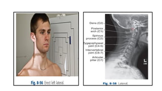 LATERAL CERVICAL VIEW lateral. Cervical.pptx